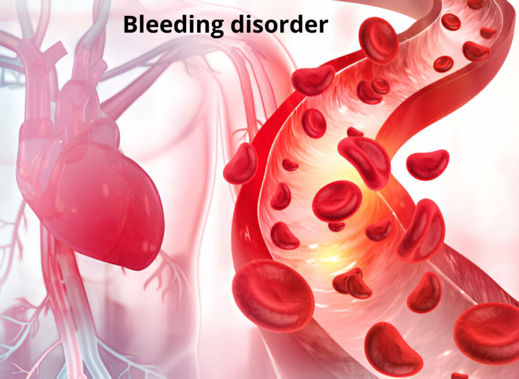 bleeding disorder treatment in Pune | bleeding disorder specialist in ...