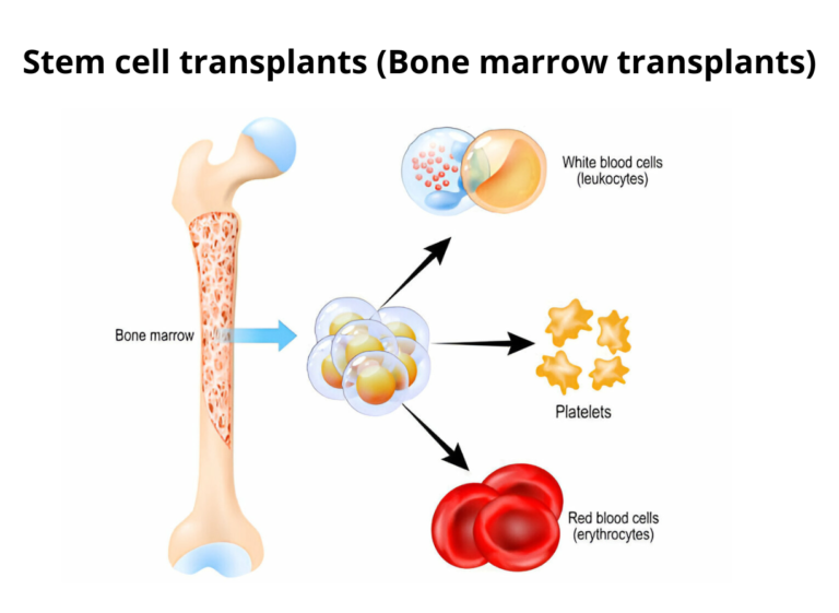 Bone Marrow Transplant Specialist in Pune | Bone Marrow Transplant in Pune